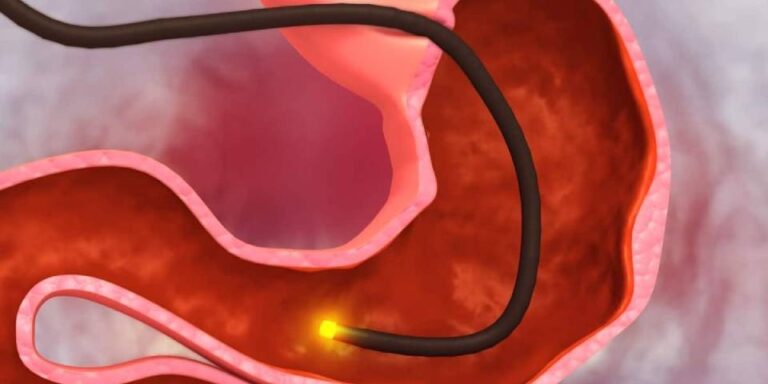 Understanding Stomach Biopsy: A Comprehensive Guide- Dr. Vikrant Kale